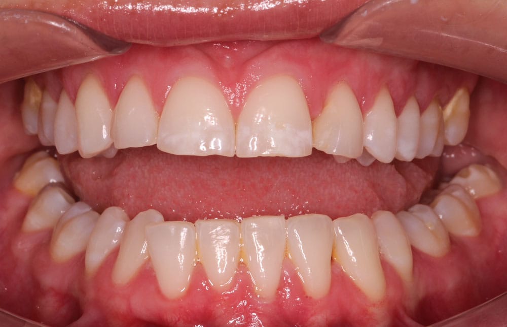 Smile Gallery - Dentist Dewsbury