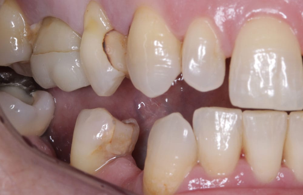 Smile Gallery - Dentist Dewsbury