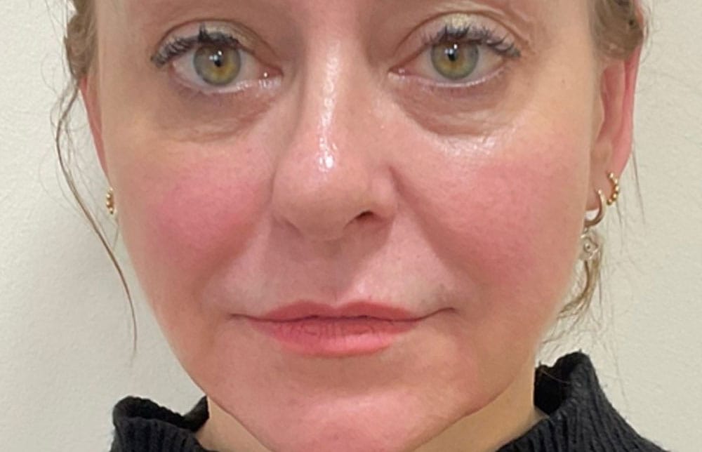 Smile Gallery - Dentist Dewsbury