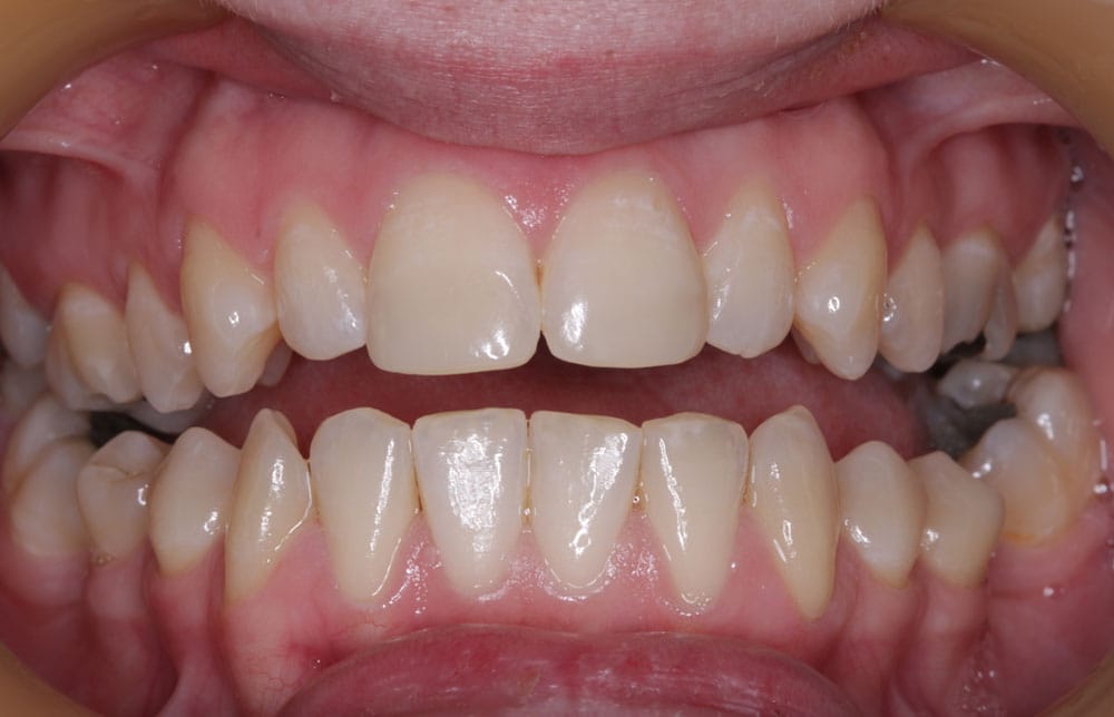 Smile Gallery - Dentist Dewsbury