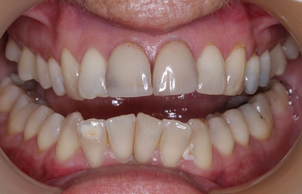 Smile Gallery - Dentist Dewsbury